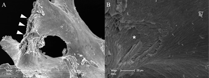Gain Bone with the Cortical Shell Technique - This Week in Implants ...